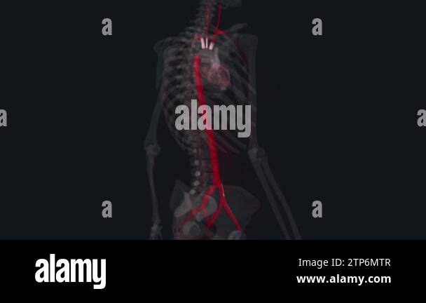 The largest artery in the body is the aorta and it is divided into four ...