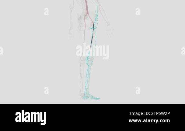 the femoral artery is a large blood vessel that provides oxygenated ...