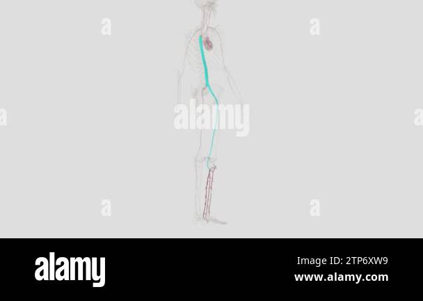 The three arteries of the lower leg are the peroneal artery, anterior ...