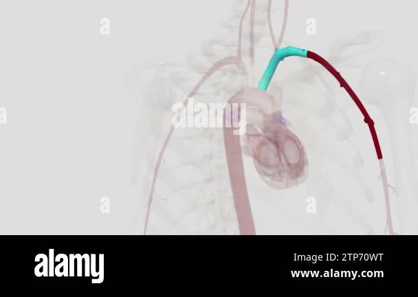 The axillary artery is a large muscular vessel that travels through the ...