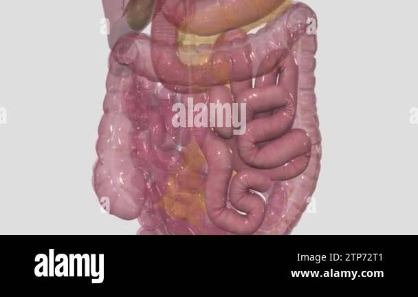 Ileum endoscopy Stock Videos & Footage - HD and 4K Video Clips - Alamy