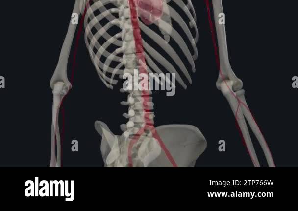 An abdominal aortic aneurysm is an enlarged area in the lower part of ...