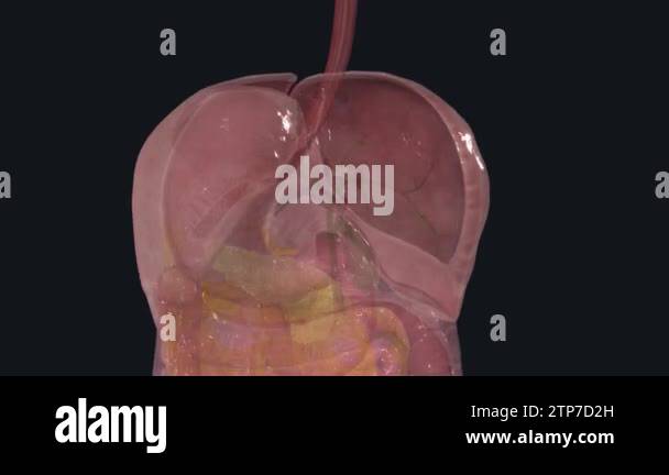 Peritoneum Stock Videos & Footage - HD and 4K Video Clips - Alamy