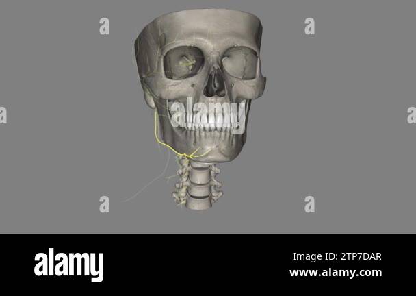 The marginal mandibular branch of the facial nerve arises from the ...