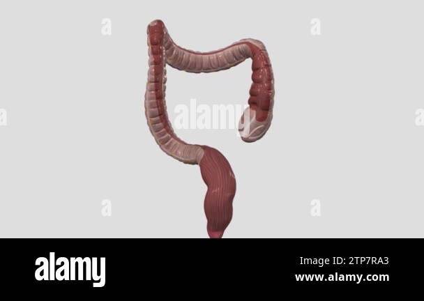 The colon, which forms most of the large intestine, is a tube of ...