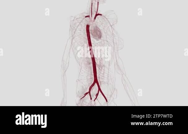 Main branches from the aorta include the brachiocephalic artery, left ...