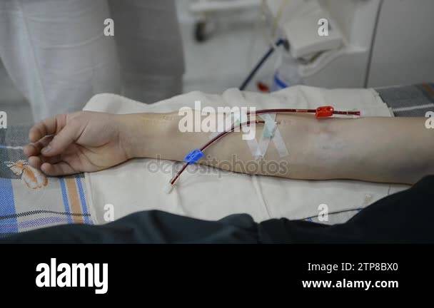 nurse prepares patients arm for dialysis Stock Video Footage - Alamy