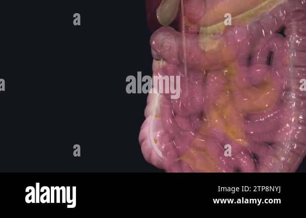 The ascending colon lies on the right side of the abdominal cavity, in ...