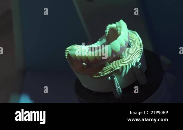 Dental prosthetic restoration. Denturist is making 3D model for ...