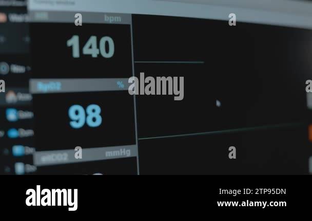 Close-up view of the screen of patient monitor displays vital signs ECG ...