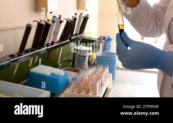 Woman lab technician working with blood samples. Close-up. Camera ...