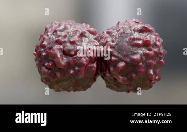 Cancer cell growth uncontrollably over tissue, Tumor infection cells ...