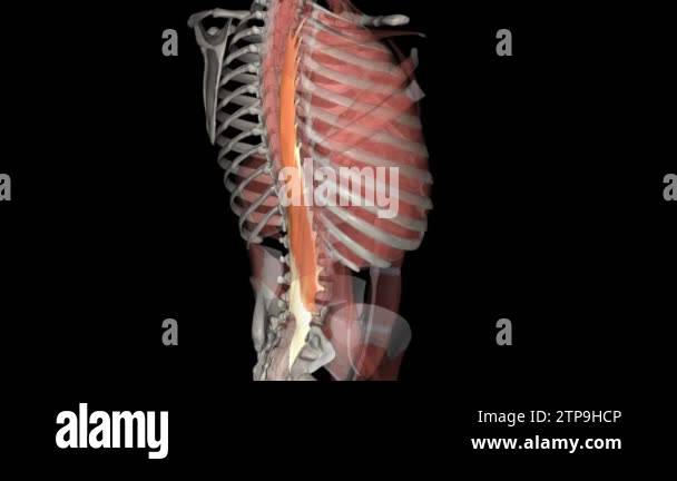 The longissimus thoracis muscle is the largest of the erector spinae ...