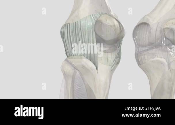 A joint capsule, also knows as an articular capsule, is a fluid-filled ...