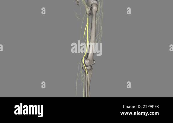The common peroneal nerve is the smaller and terminal branch of the ...