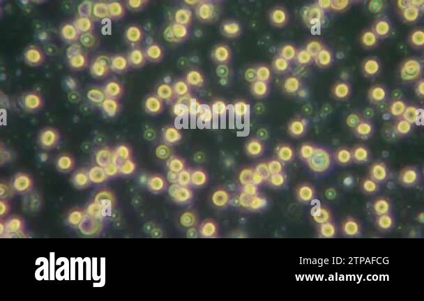 Haemoglobin analysis Stock Videos & Footage - HD and 4K Video Clips - Alamy