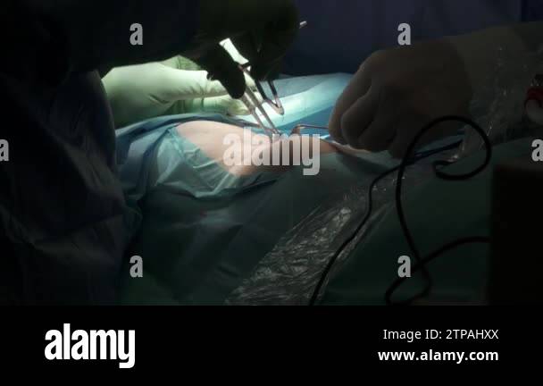 Crop unrecognizable surgeons in latex gloves using forceps and scissors ...