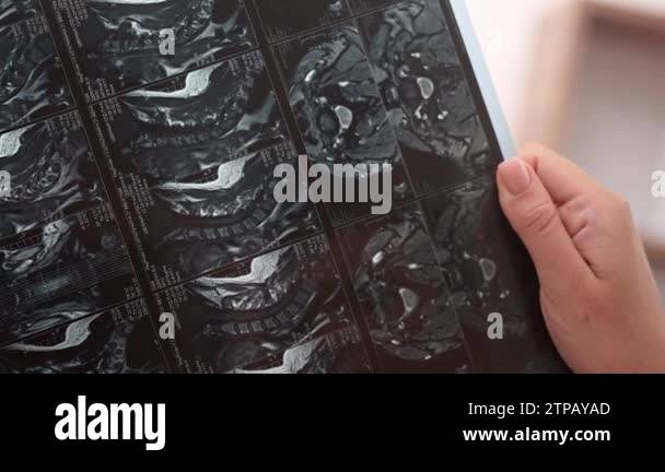 close up doctor hands examining patient X-ray films and MRI scans with ...