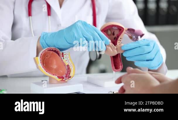 Doctor gynecologist showing patient fertilization process on artificial ...