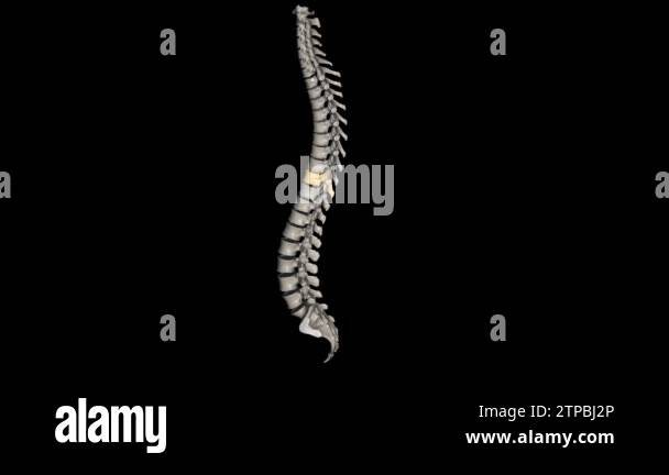 Thoracic Vertebral, T9 Twelve vertebrae are located in the thoracic ...