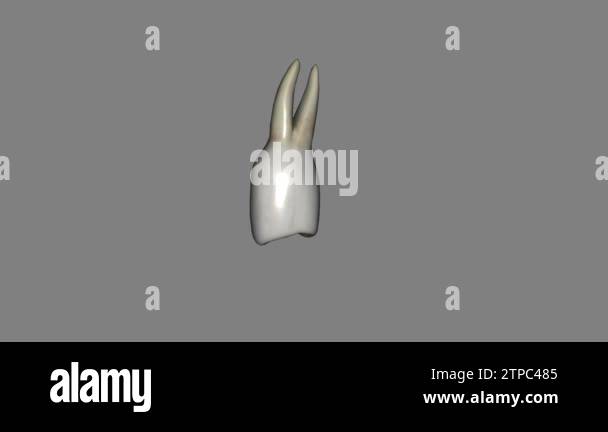 The mandibular first premolar has a bulkier crown compared to the ...