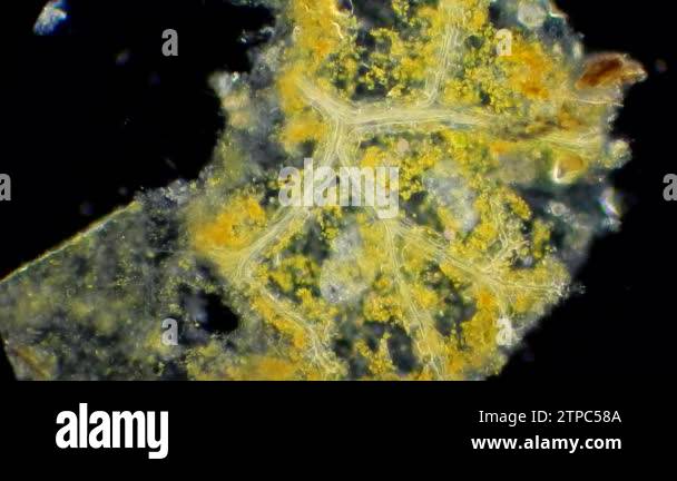 Infusoria cell division Stock Videos & Footage - HD and 4K Video Clips ...