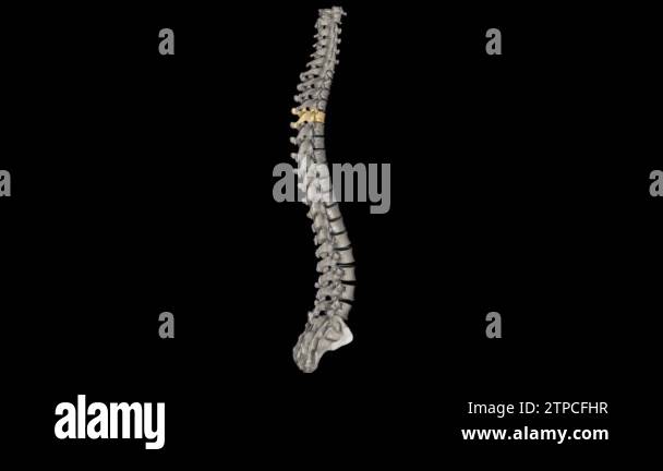 Thoracic Vertebral, T4 Twelve vertebrae are located in the thoracic ...