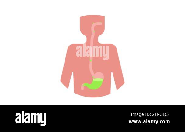 Reflux stomach symbol Stock Videos & Footage - HD and 4K Video Clips ...
