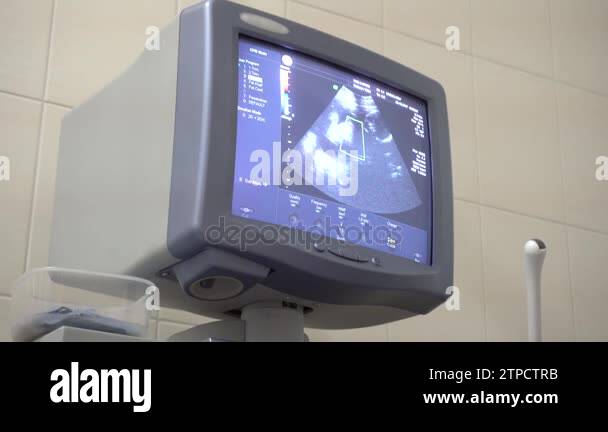 Image of female womb on monitor ultrasound examination equipment ...
