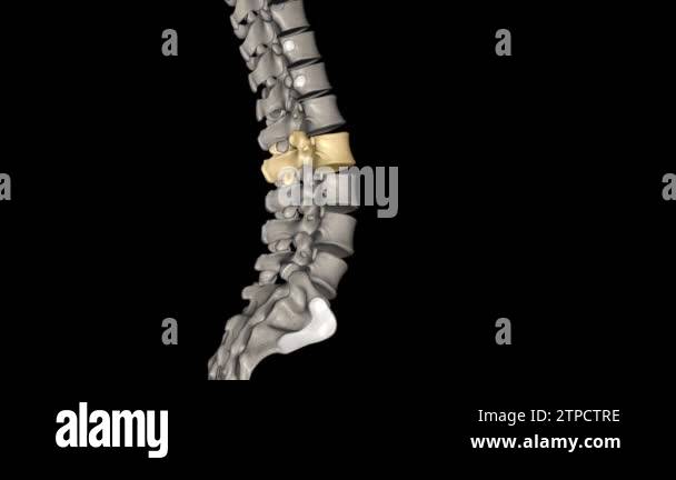 The L2 vertebra is located in the lower curvature of the spine, and the ...