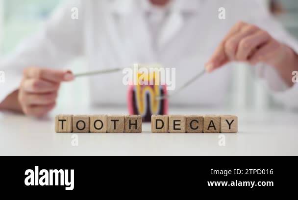Dentist shows artificial tooth tooth decay. Dental caries caused by ...
