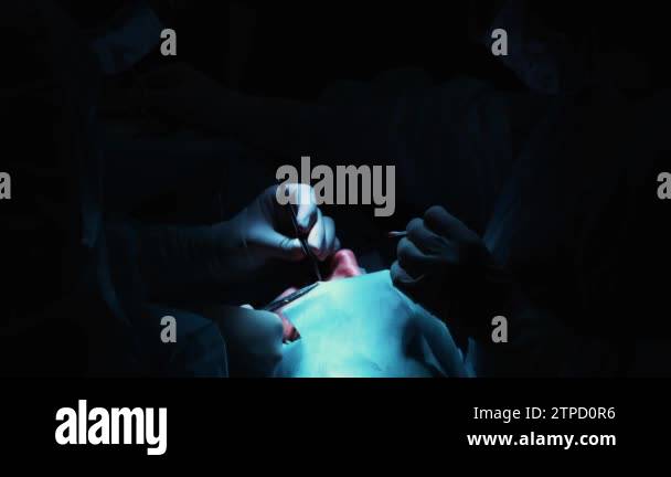 The surgeon is performing an operation on the eyes, close-up ...