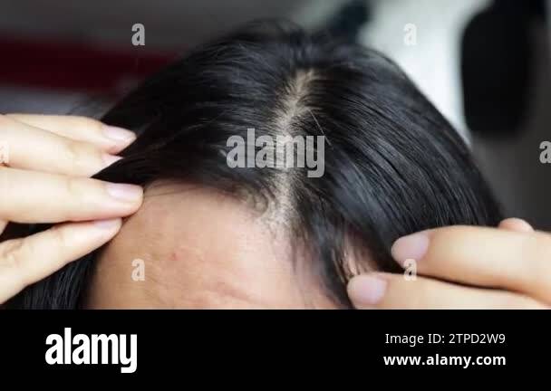 young woman examining her scalp and hair in mirror, hair roots, color ...