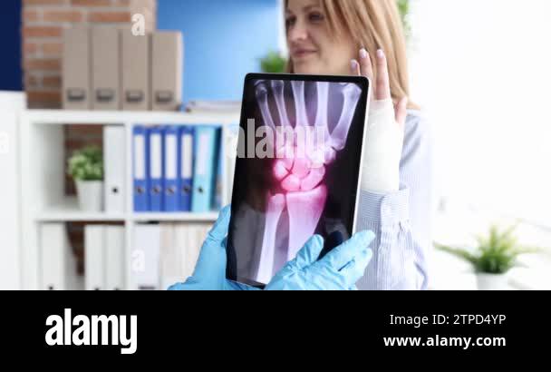 Doctor holds tablet with X-ray shot of patient hand. Ligament and ...