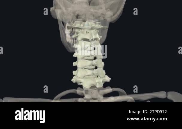 The cervical spine, comprised of seven cervical vertebrae referred to ...