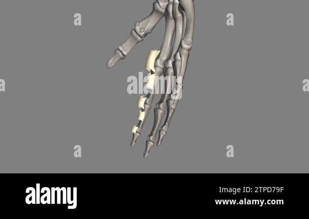 The annular ligament is a complex structure formed from the capsule ...