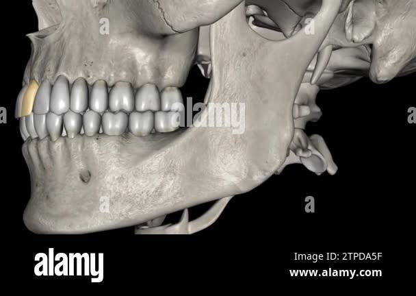 The maxillary central incisors are centered in the maxilla, one on ...