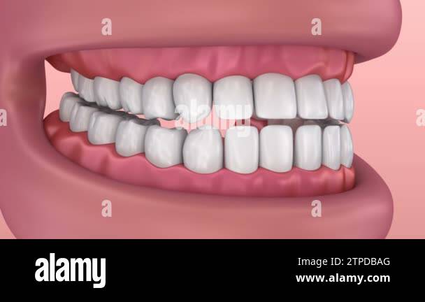 Mouth gum and teeth. Medically accurate tooth 3D animation Stock Video ...