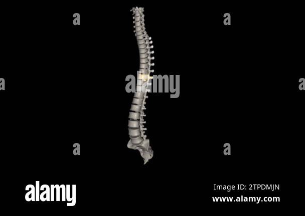 Thoracic Vertebral, T8 Twelve vertebrae are located in the thoracic ...