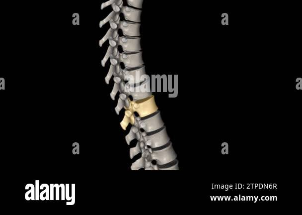 Thoracic Vertebral, T10 Twelve vertebrae are located in the thoracic ...