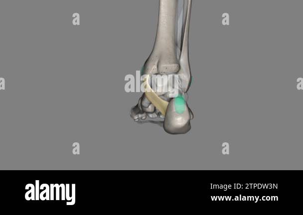 The flexor retinaculum of the foot extends from the medial malleolus ...