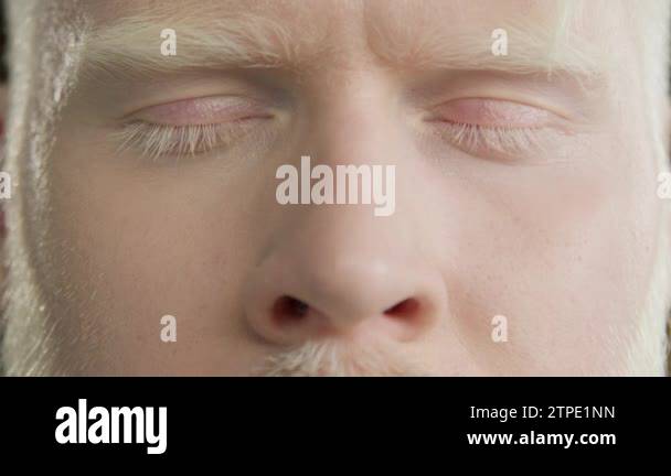 Marco close up blue eyes of handsome albino man. Calm relaxed man ...