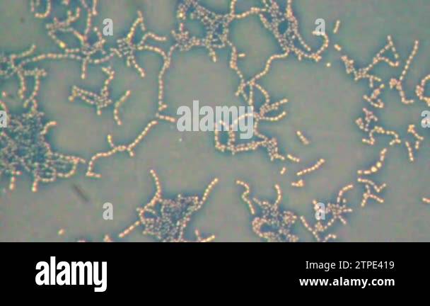 Bacteria under microscope Stock Video Footage - Alamy