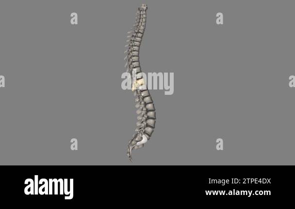 Thoracic Vertebral, T10 Twelve vertebrae are located in the thoracic ...