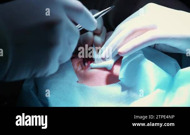 The surgeon is performing an operation on the eyes, close-up ...