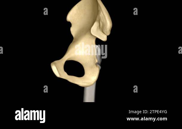 The hip bone is comprised of the three parts the ilium, pubis and ...