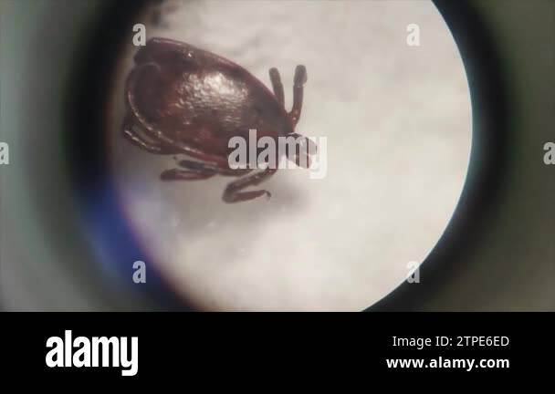 Acari mite under microscope. Ixodes tick. Tick-borne disease Stock ...