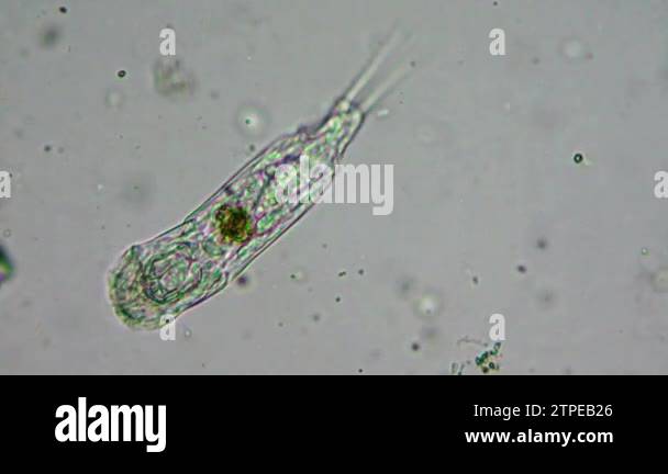 Protozoa mitosis Stock Videos & Footage - HD and 4K Video Clips - Alamy