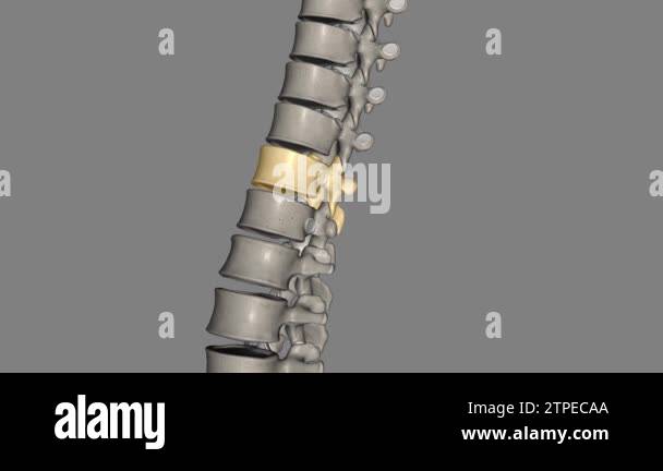 Thoracic Vertebral, T12 Twelve vertebrae are located in the thoracic ...