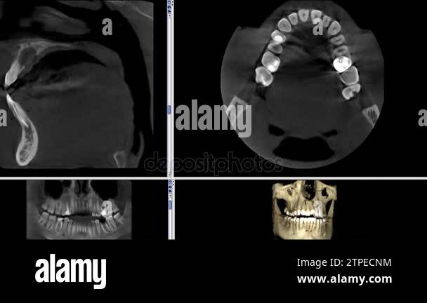 real life MRI scan of man jaws for stomatology dentist research new ...